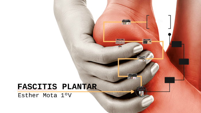 FASCITIS PLANTAR by esther mota on Prezi