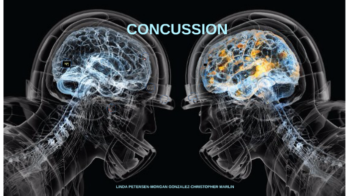 CONCUSSION by Morgan Gonzalez on Prezi