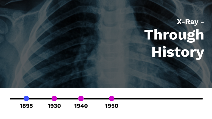 History of X-Ray by Lola Cazabon on Prezi