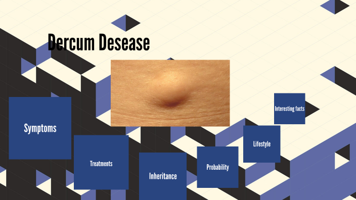 Dercum Disease by Lincoln Froh _ Student - WakefieldHS on Prezi