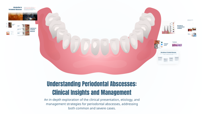 Understanding Periodontal Abscesses: Clinical Insights and Management ...