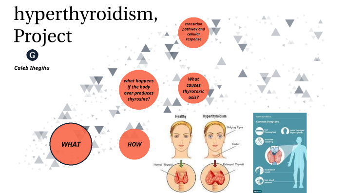 hyperthyroidism, project by Caleb Ihegihu on Prezi