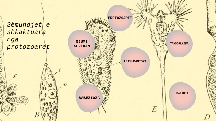 Semundjet e shkaktuara nga protozoaret by junis baholli on Prezi