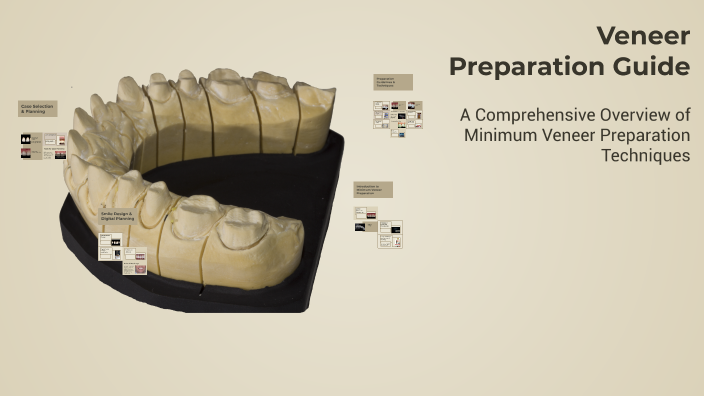 Veneer Preparation Guide by mustafa namuq on Prezi