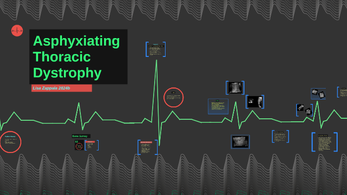 Asphyxiating Thoracic Dystrophy by lisa zappala on Prezi