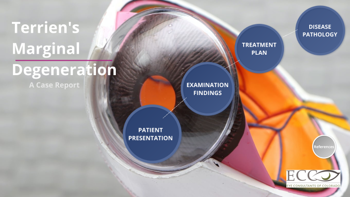 Terrien's Marginal Degeneration by Katelyn Neillands on Prezi