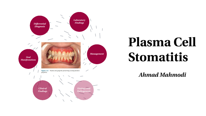 Plasma Cell Stomatitis by fatemeh ebrahimi on Prezi