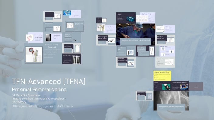 TFN-Advanced Proximal Femoral Nailing by Ben Sweetman on Prezi