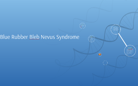 Blue Rubber Bleb Nevus Syndrome by Colleen Murphy on Prezi