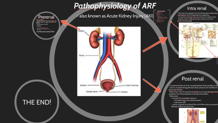 Pathophysiology of ARF by Tan Yan Wei on Prezi