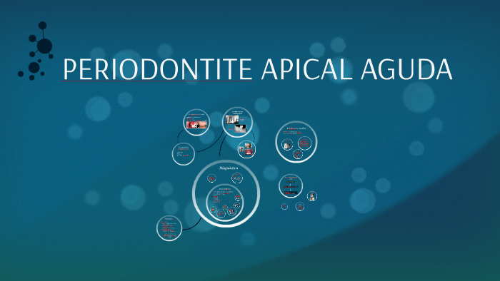 PERIODONTITE APICAL AGUDA by Maria Machado on Prezi