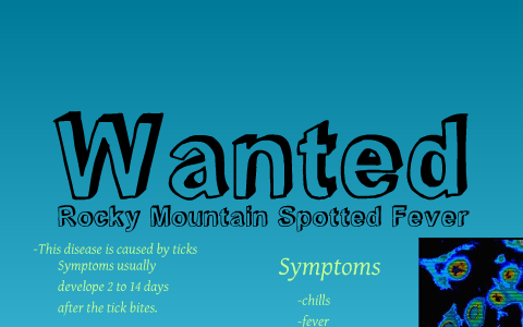 Wanted Bacteria by Julia McMillan on Prezi