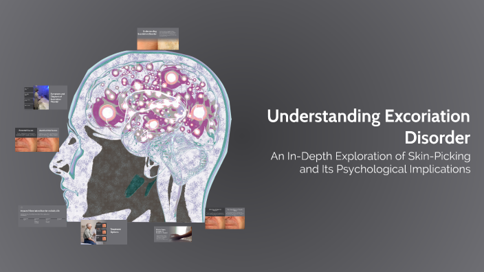 Understanding Excoriation Disorder by Kemi Thomas on Prezi