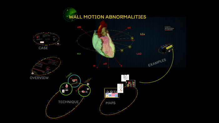 WALL MOTION ABNORMALITIES by Craig Brick on Prezi