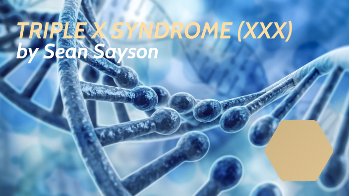 Triple X Syndrome by Sean Sayson on Prezi