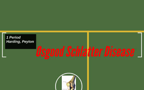 Osgood Schlatter Disease by Peyton Harding on Prezi