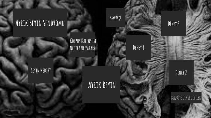 Ayrık Beyin Sendromu by Deniz on Prezi