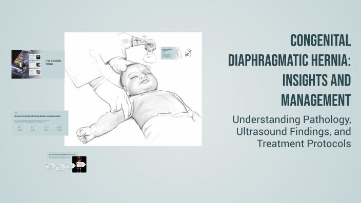 Congenital Diaphragmatic Hernia: Insights and Management by Abeer on Prezi