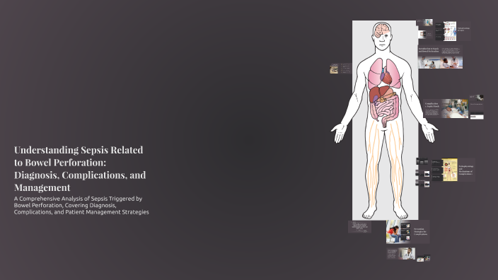 Understanding Sepsis Related to Bowel Perforation: Diagnosis ...