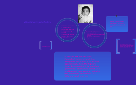 Weissenbacher-Zweymuller Syndrome by rebecca sanford on Prezi