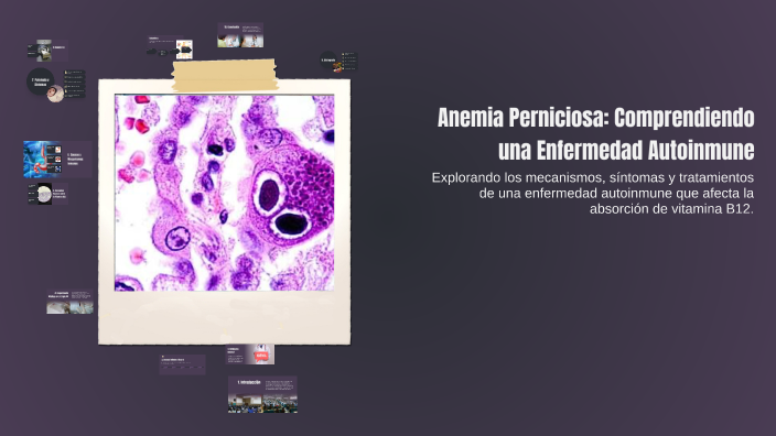 Anemia Perniciosa: Comprendiendo una Enfermedad Autoinmune by Sarah ...