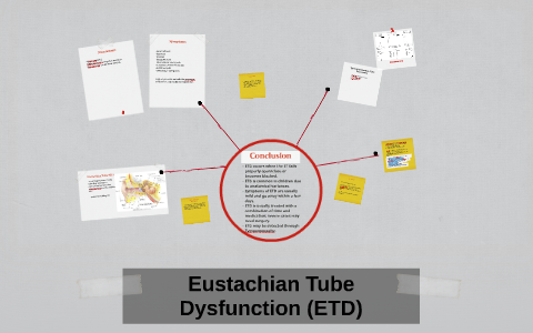 Eustachian Tube Dysfunction by Taylor Lowe on Prezi