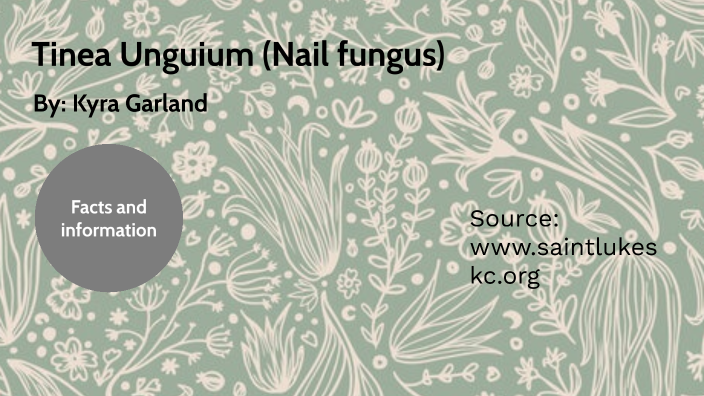Tinea Unguium by Kyra Garland on Prezi