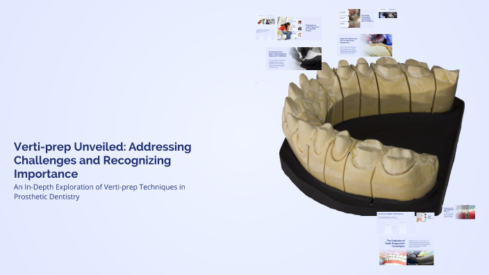 Verti-prep Unveiled: Addressing Challenges and Recognizing Importance ...