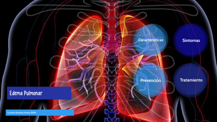 Edema pulmonar by Luciana Sanjines on Prezi