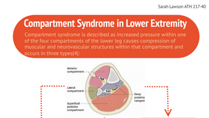 Compartment Syndrome of the Lower Leg by Sarah Lawson on Prezi Design