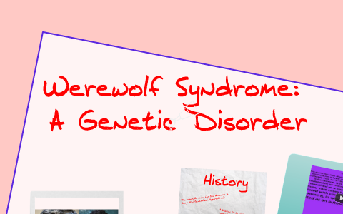 Werewolf Syndrome: A Genetic Disorder by Kylie Johnson on Prezi