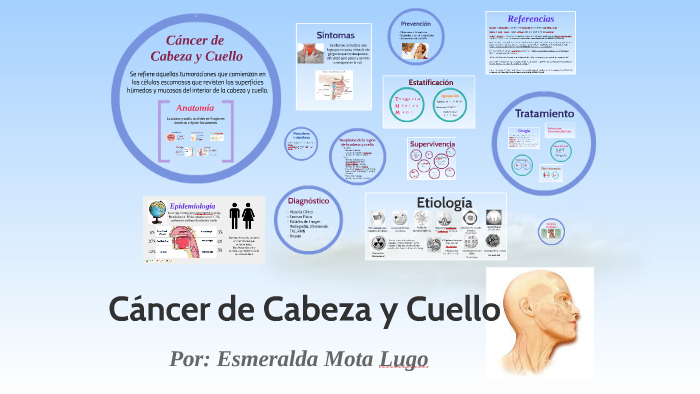 Cáncer de Cabeza y Cuello by Esme MoLu on Prezi