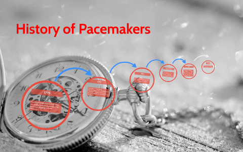 History of Pacemakers by Nirmin Mohamed on Prezi