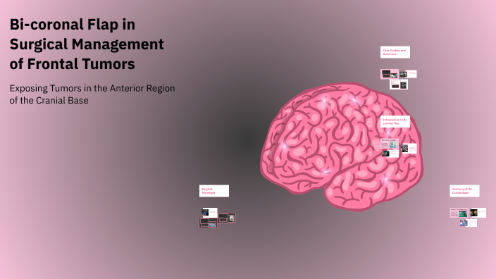 Bi-coronal Flap in Surgical Management of Frontal Tumors by Aymen Hager ...