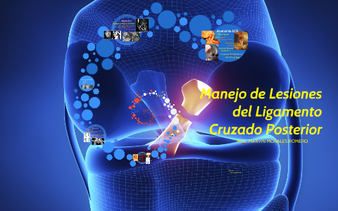Manejo Lesiones Ligamento Cruzado Posterior by Marvin Morales on Prezi