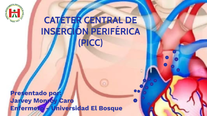 CATETER PICC by Jarvey Monroy Caro on Prezi