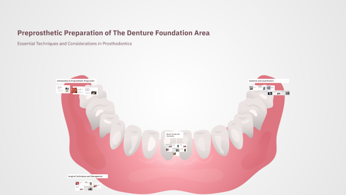 Preprosthetic Preparation of The Denture Foundation Area by Mahmoud ...