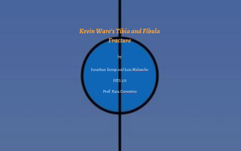 Kevin Ware’s Tibia and Fibula Fracture by Luis Malanche on Prezi