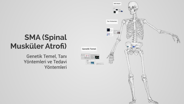 SMA (Spinal Musküler Atrofi) by Sıla Aksu on Prezi