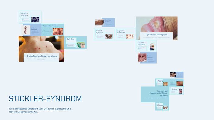STICKLER-SYNDROM by Mohamed Ashour on Prezi