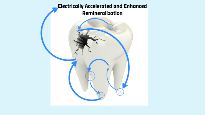 Electrically Accelerated and Enhanced Remineralization by Jorge Lopez ...