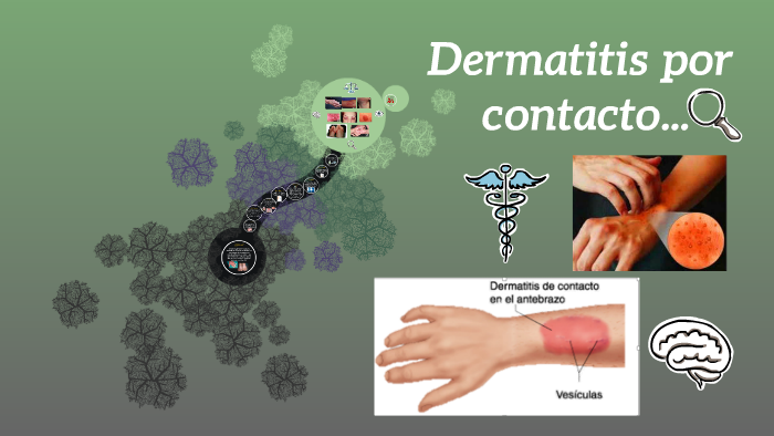 Dermatitis por contacto... by Tatiana Peña on Prezi