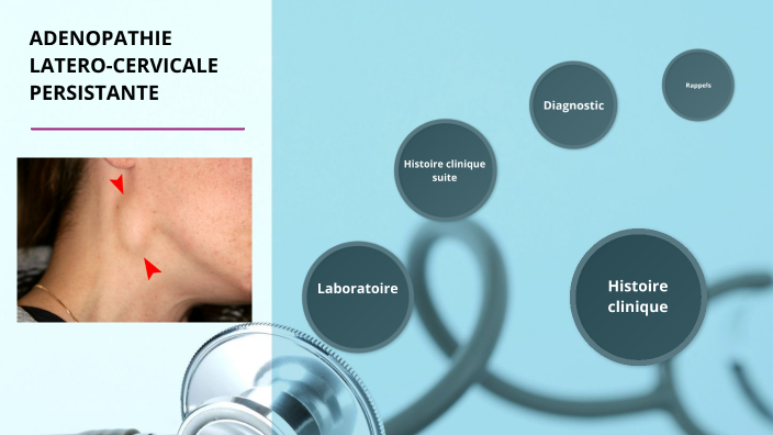 ADENOPATHIE LATEROCERVICALE PERSITANTE by Walter Gusmini on Prezi