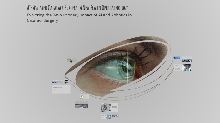 AI-Assisted Cataract Surgery: A New Era in Ophthalmology by Merranda ...