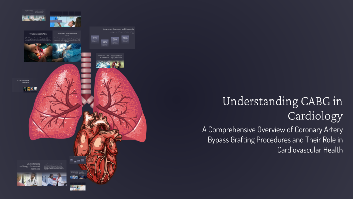 Understanding CABG in Cardiology by fiza ansari on Prezi