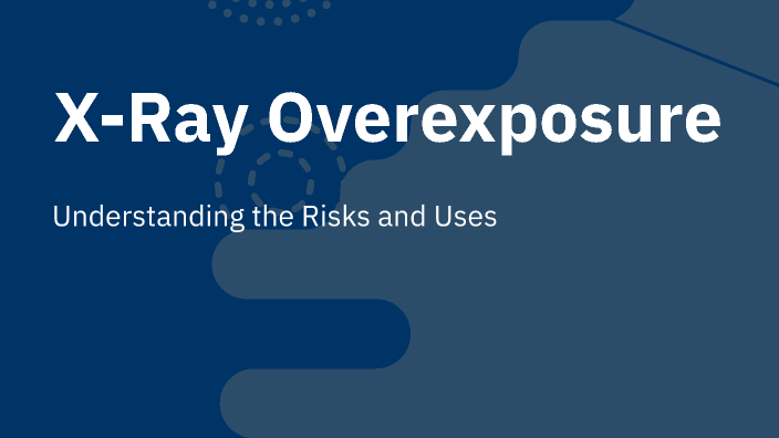 X-Ray Overexposure - Frankie and Manal by Franklin Thomas on Prezi