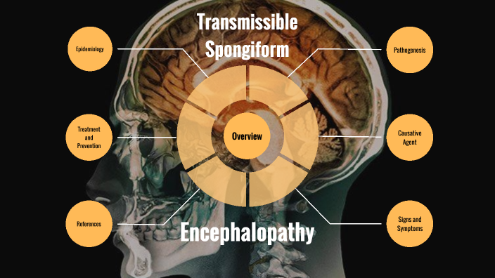 Encephalopathy Presentation by Kalib Correa on Prezi