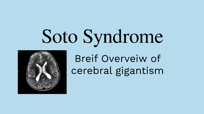 Soto Syndrome by carly jeffares on Prezi