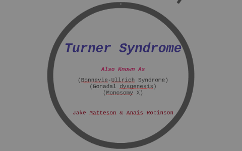 Turner Syndrome by Jake Matteson on Prezi