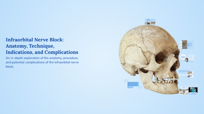 Infraorbital Nerve Block: Anatomy, Technique, Indications, and ...